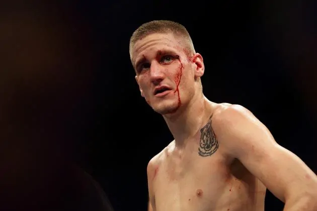 Will Chope vs. Diego Brandao Off, Chope Fired From the UFC